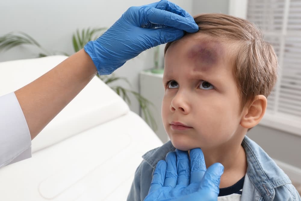 What Are the Most Common Examples of TBI | Fuicelli & Lee